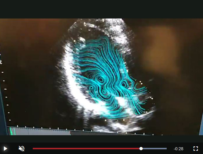 The Core of the Heart is a Vortex — AHA! Discovery on Healing Requires ...